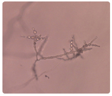Pythium — Department of Plant Pathology and Environmental Microbiology